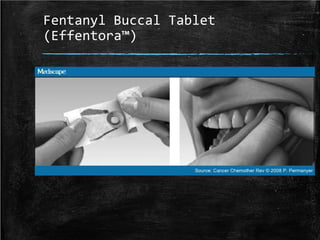 Buccal drug delivery regulatory guidelines | PPT