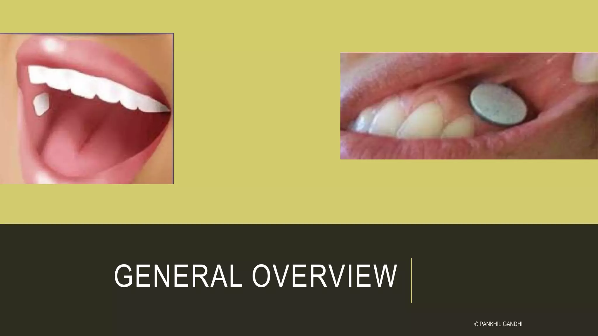 Buccal Drug Delivery System | PPT