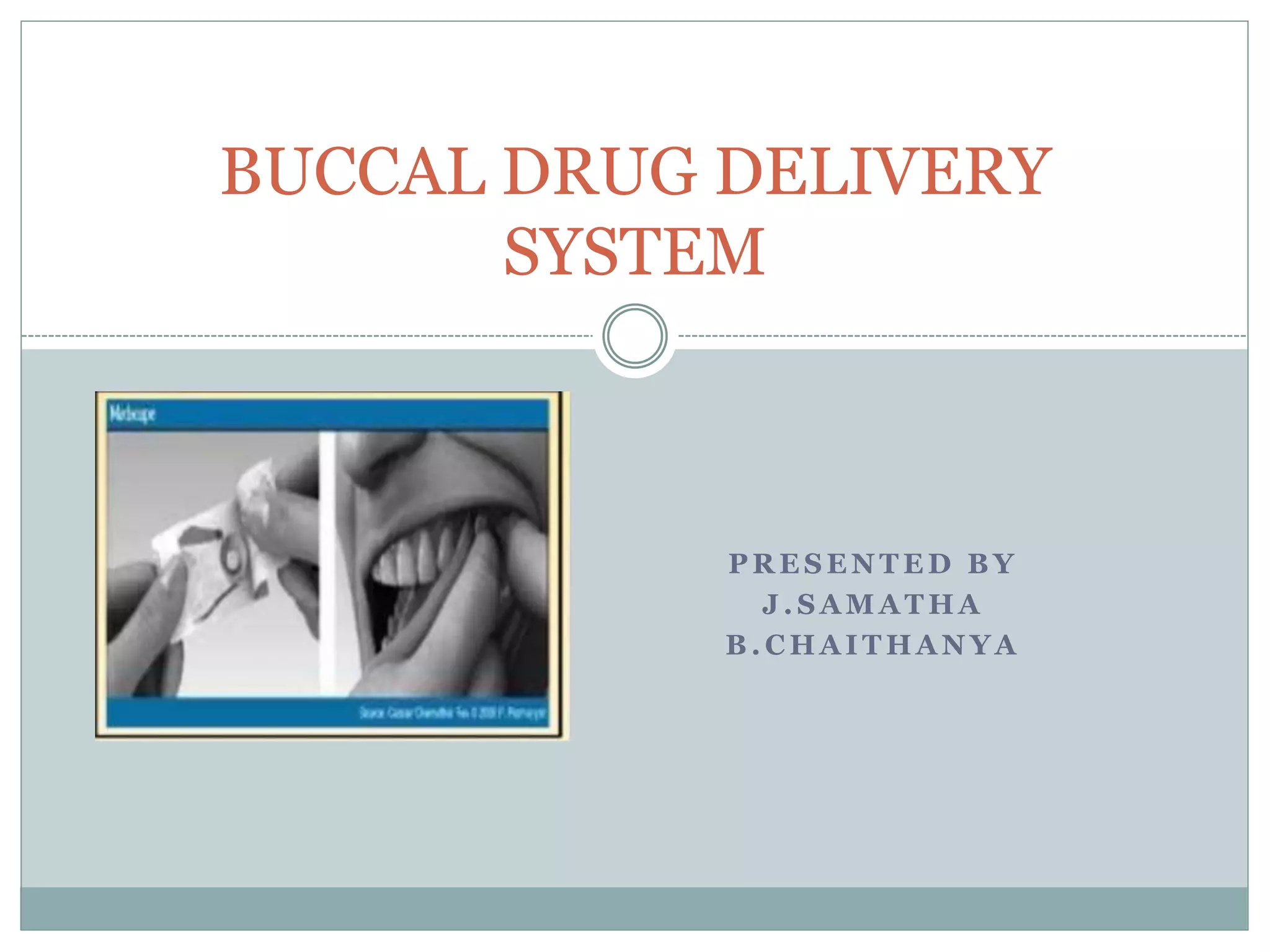 Buccal drug delivery system | PPTX