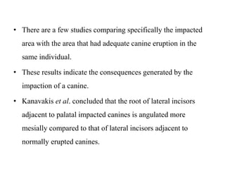 12.Buccally Erupted Maxillary Canine.pptx