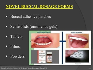 Buccal drug delivery system, by dr. umesh kumar sharma and shyma m s | PPTX