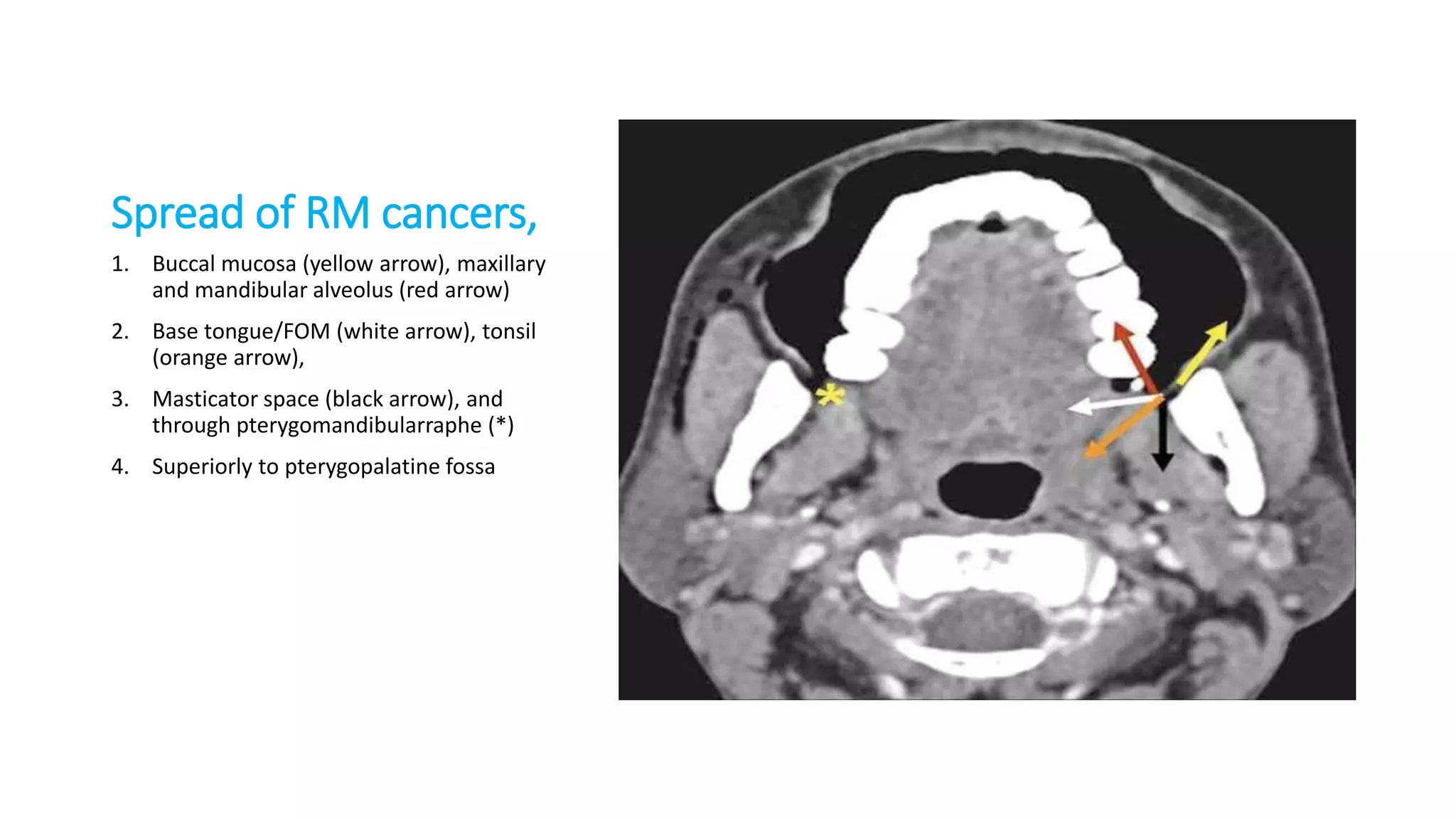 Normal Anatomy of Buccal mucosa and cancer | PPTX