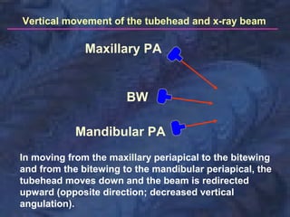 Buccal Object Rule | PPT