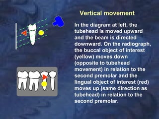 Buccal Object Rule | PPT