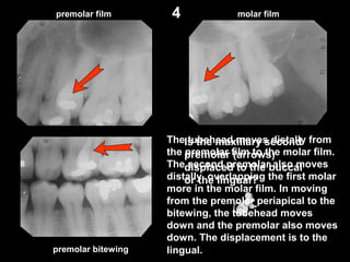 Buccal Object Rule | PPT