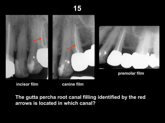 Buccal Object Rule | PPT