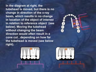 Buccal Object Rule | PPT
