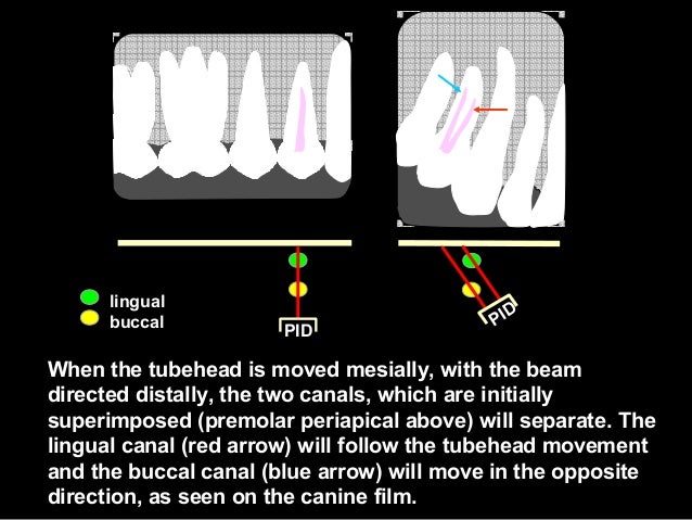 Buccal Object Rule