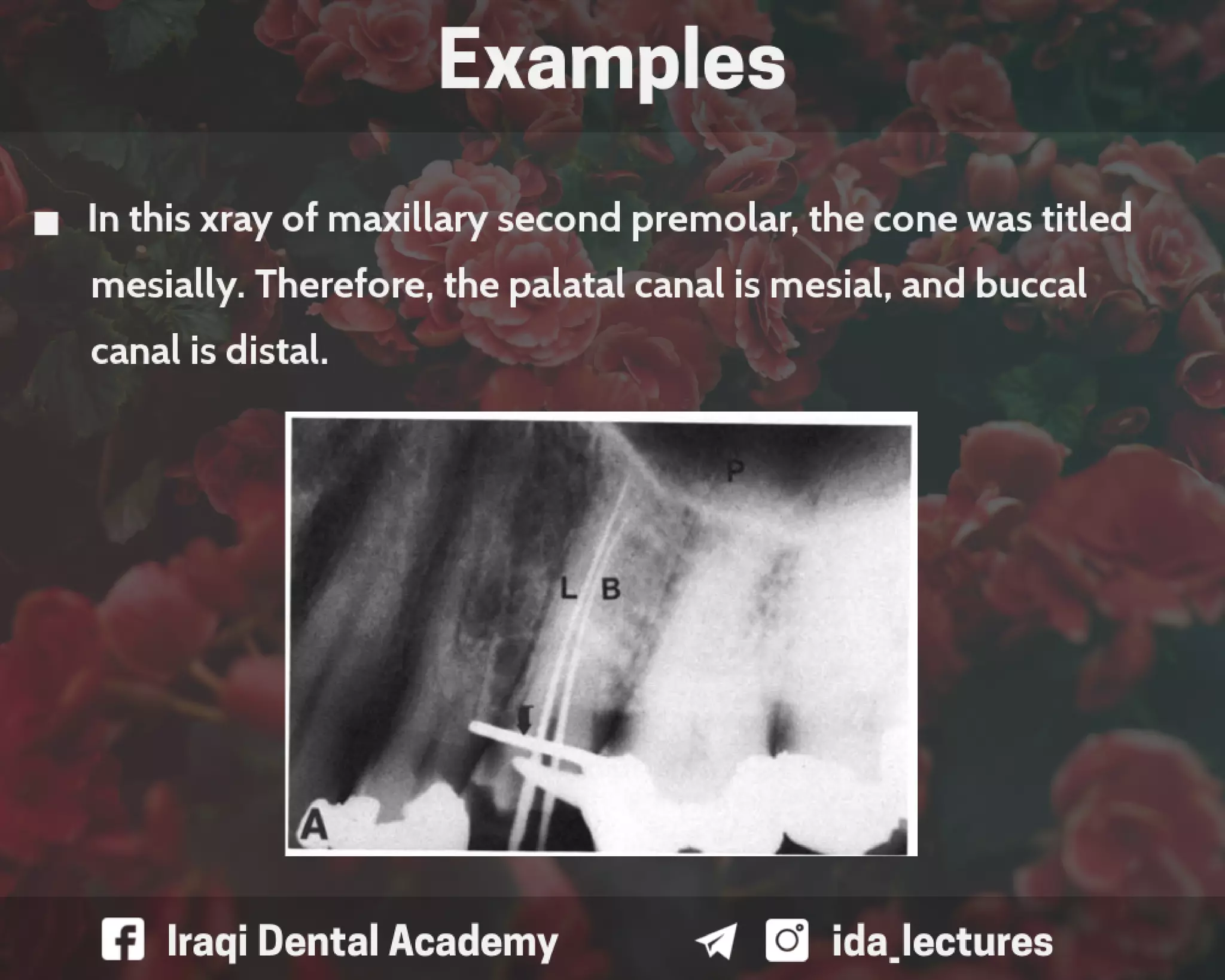 Buccal Object Rule - A Radiographic Aid in Dental Practice. | PDF