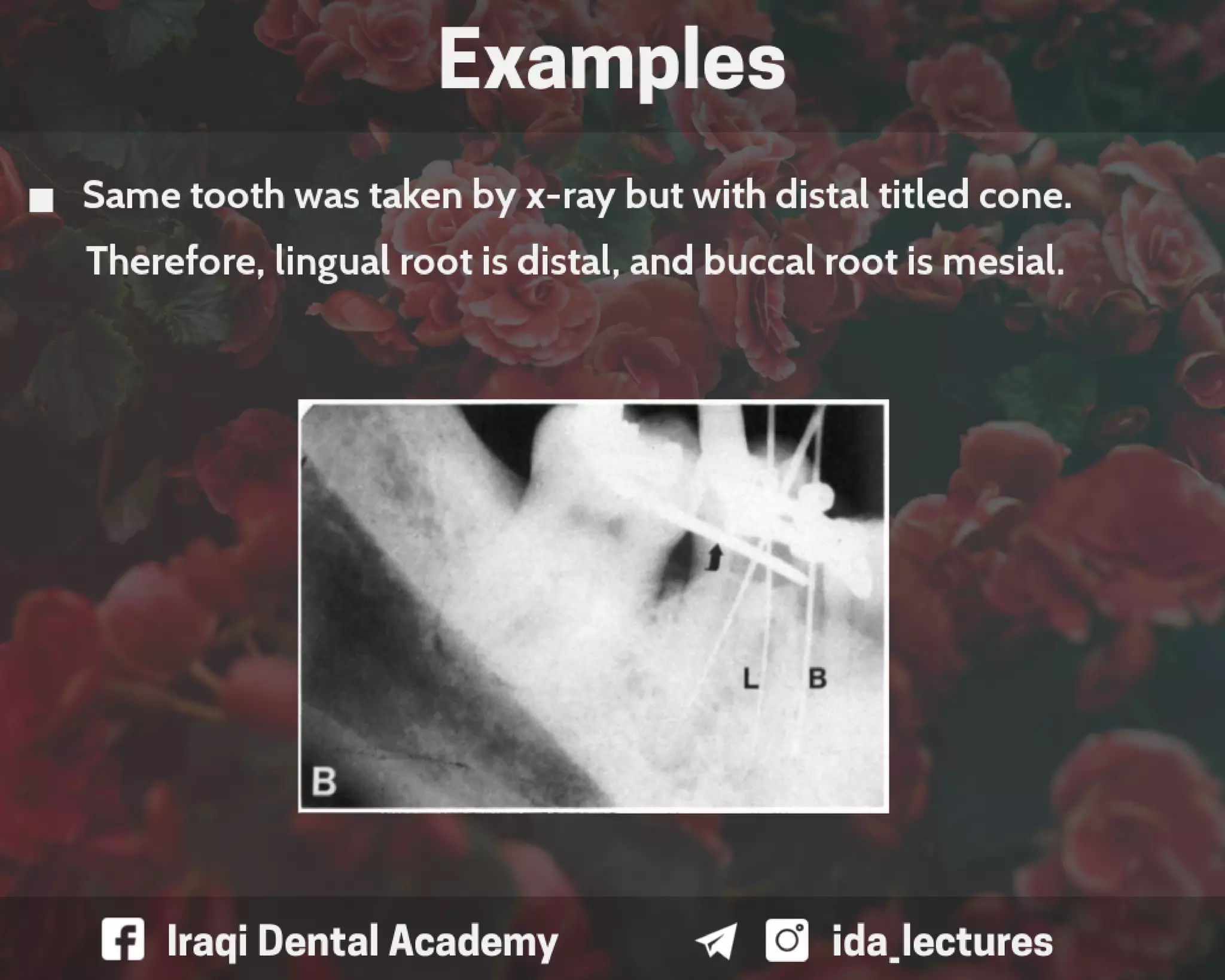 Buccal Object Rule - A Radiographic Aid in Dental Practice. | PDF