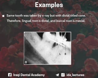 Buccal Object Rule - A Radiographic Aid in Dental Practice. | PDF
