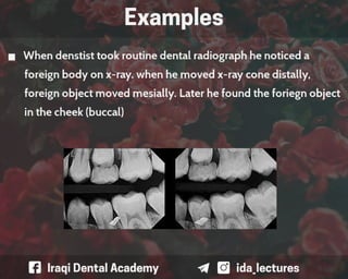 Buccal Object Rule - A Radiographic Aid in Dental Practice. | PDF