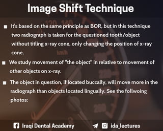 Buccal Object Rule - A Radiographic Aid in Dental Practice. | PDF