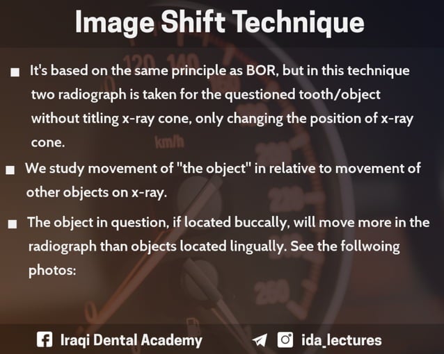 Buccal Object Rule - A Radiographic Aid in Dental Practice. | PDF