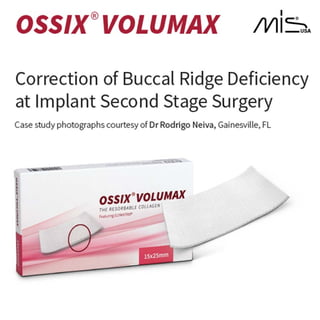OSSIX VOLUMAX Buccal Ridge Deficiency Case | PDF | Dental Health ...