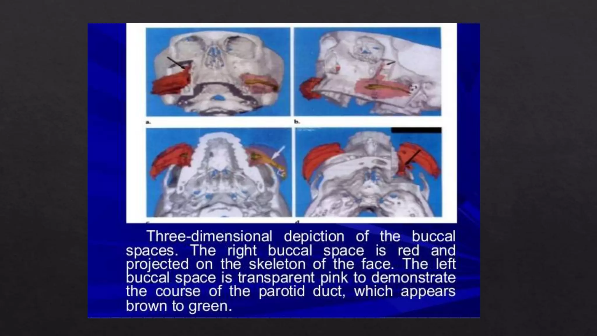 Buccal space anatomy | PPTX