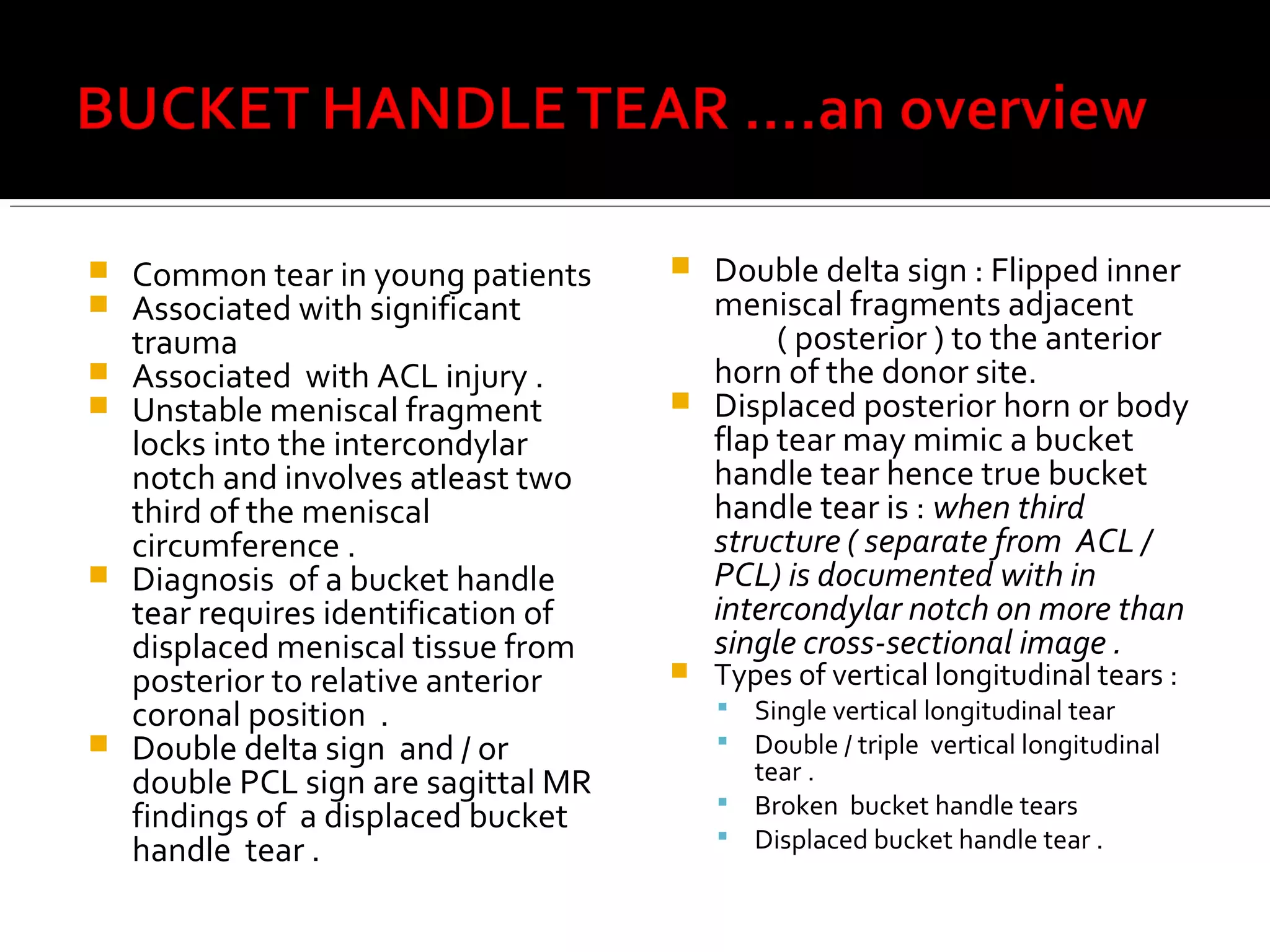Bucket handle tear | PPT