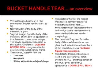 Bucket handle tear | PPT