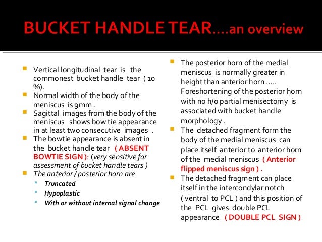 Bucket handle tear