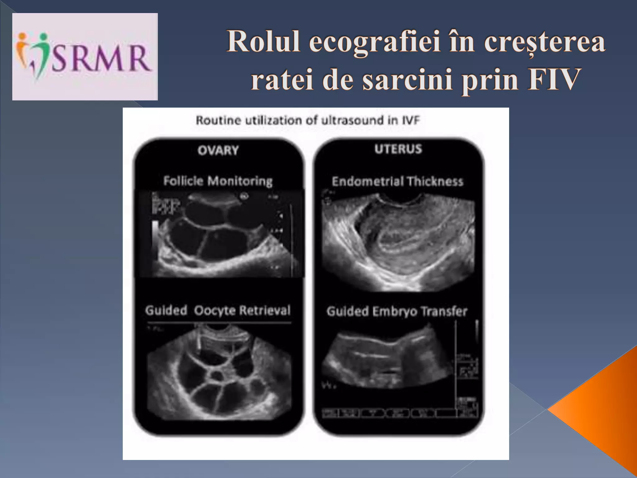 bucuresti sept 2022 MIRCEA ONOFRIESCU.pptx