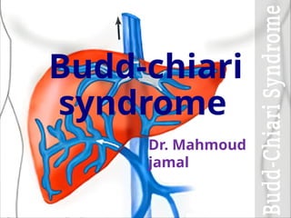 Budd chiari syndrome by Dr. Mahmoud jamal | PPTX