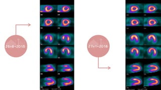 MPI , nuclear cardiac | PDF