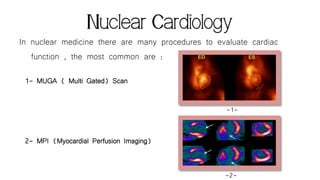 MPI , nuclear cardiac | PDF