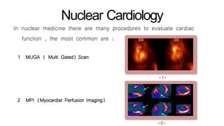 Nuclear Medicine - MPI - Case Study | PPTX