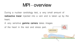 Nuclear Medicine - MPI - Case Study | PPTX