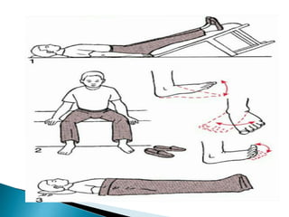 BUERGER ALLEN EXERCISE PPT.pptx