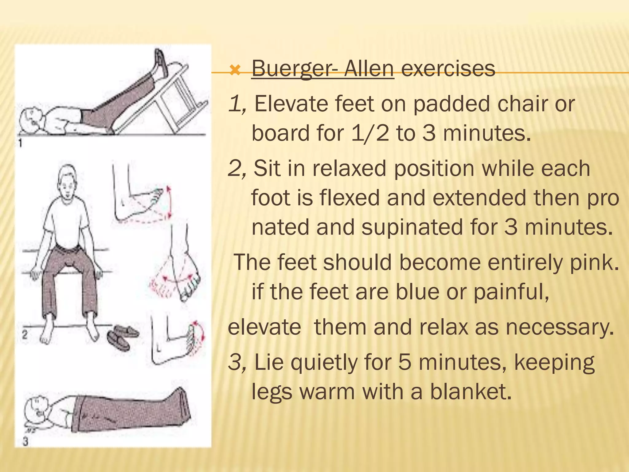 Buerger allens exercises | PDF