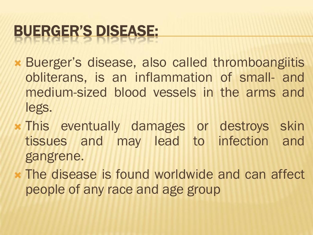 Buerger Allens Exercises