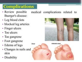 Buerger's disease | PPTX | Blood Disorders | Diseases and Conditions