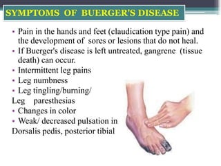 Buerger's disease | PPTX
