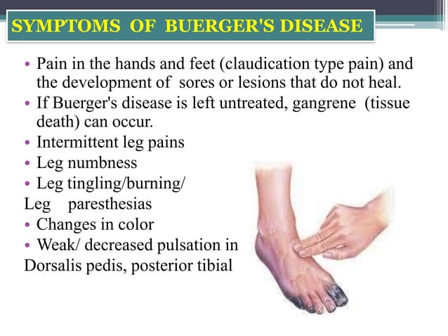 Buerger's disease | PPTX | Blood Disorders | Diseases and Conditions