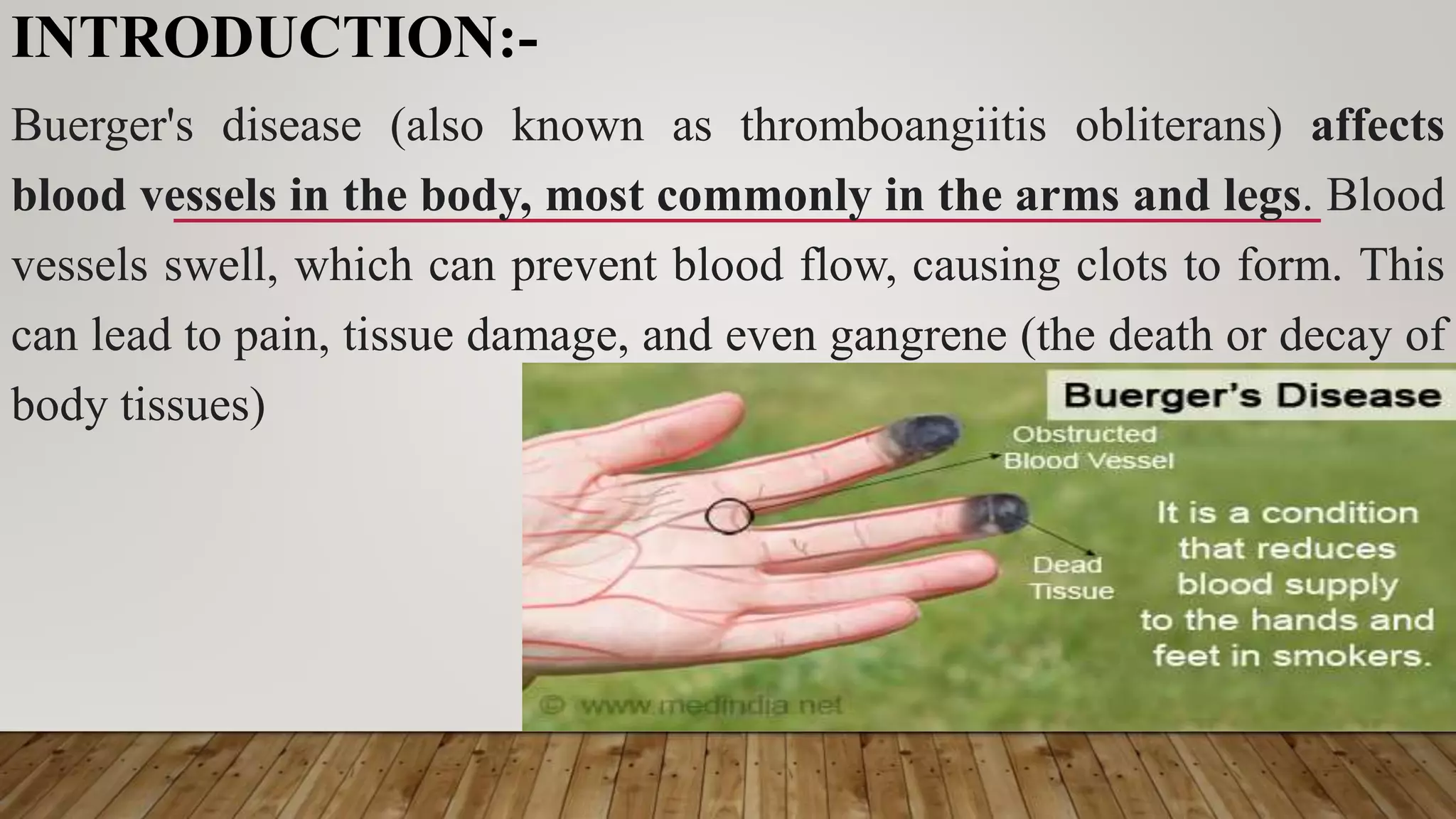 Buerger’s disease.pdf