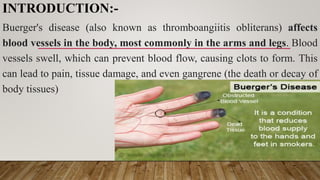 Buerger’s disease.pdf