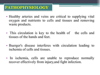 Buerger's disease ( Thromboangiitis obliterans) | PDF