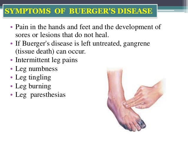 Buerger's disease ( Thromboangiitis obliterans)