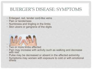 Buergers disease facts | PPTX