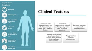 Buerger’s Disease (Thromboangiitis Obliterans) | PPTX