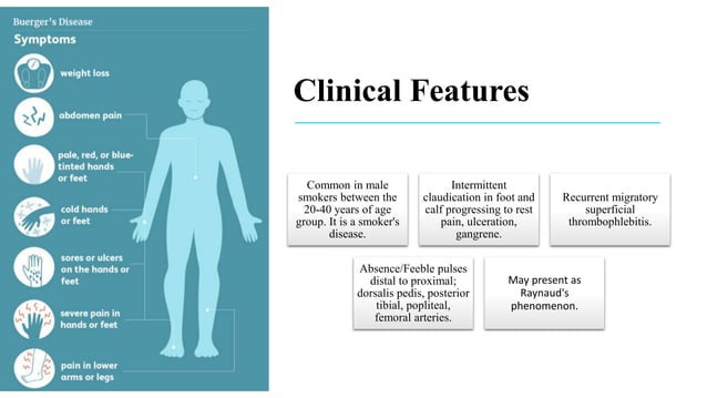 Buerger’s Disease (Thromboangiitis Obliterans) | PPTX | Foot Health ...