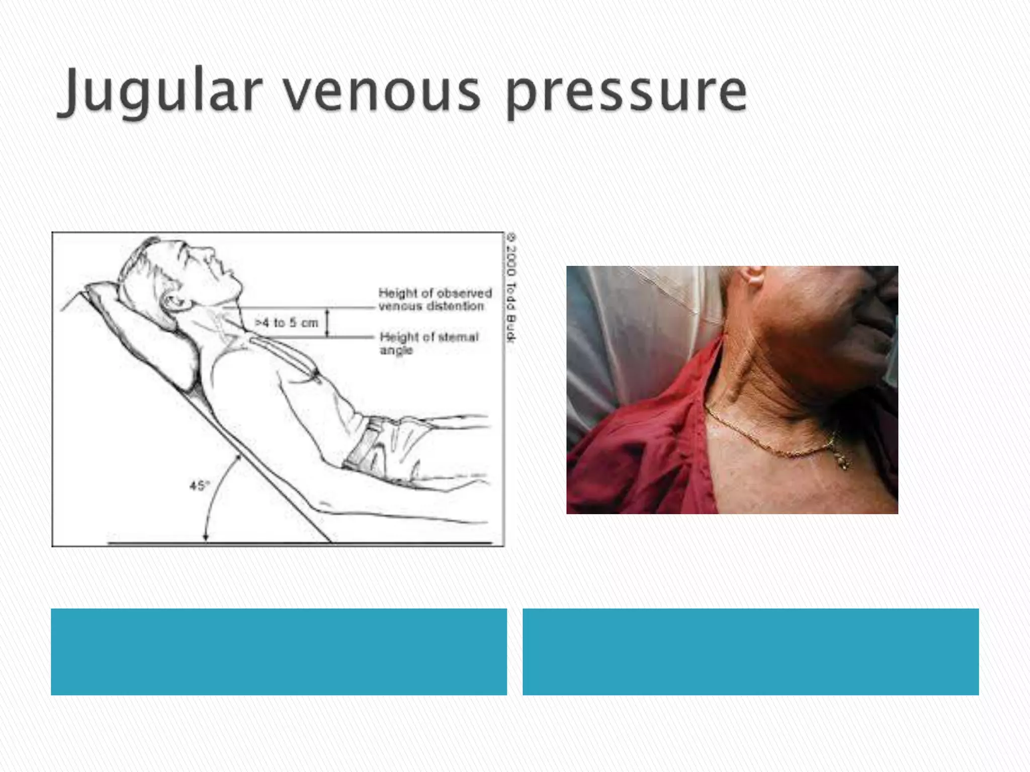 Bugando Cardiac Physical Exam.pptx