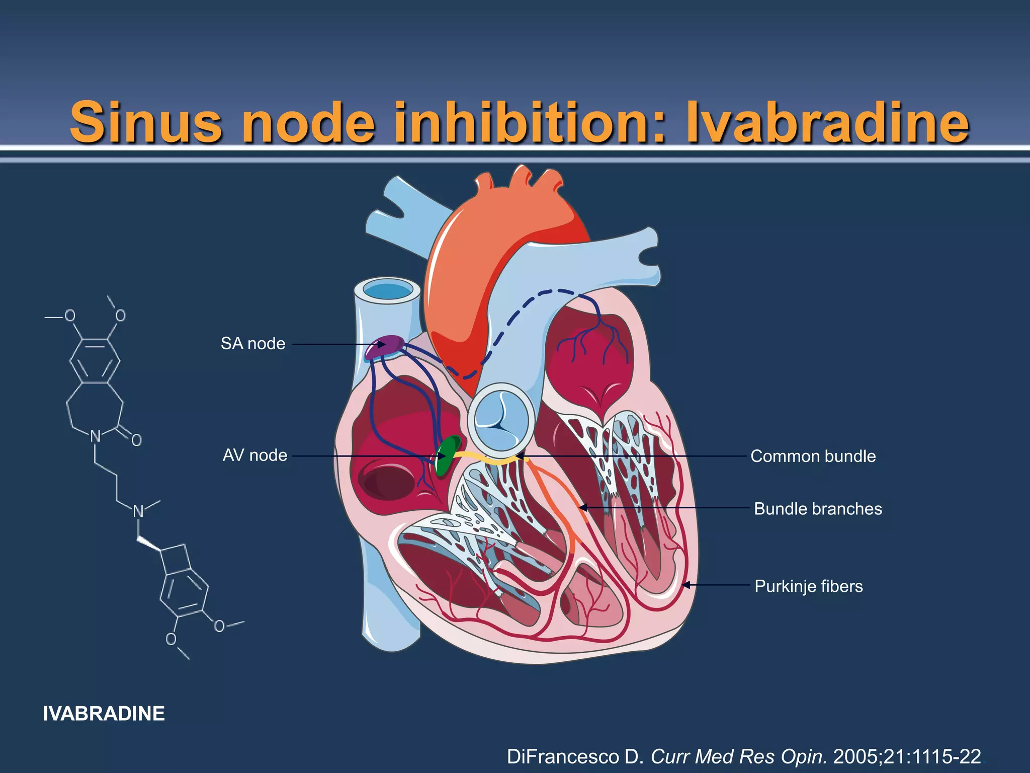Antiangina_treatment_.ppt