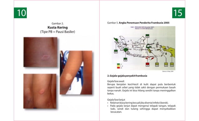 BUKU PANDUAN KUSTA FRAMBUSIA - PKK.pdf