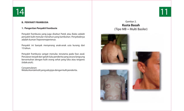 BUKU PANDUAN KUSTA FRAMBUSIA - PKK.pdf