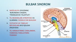 Bulbar sindromlar | PPT