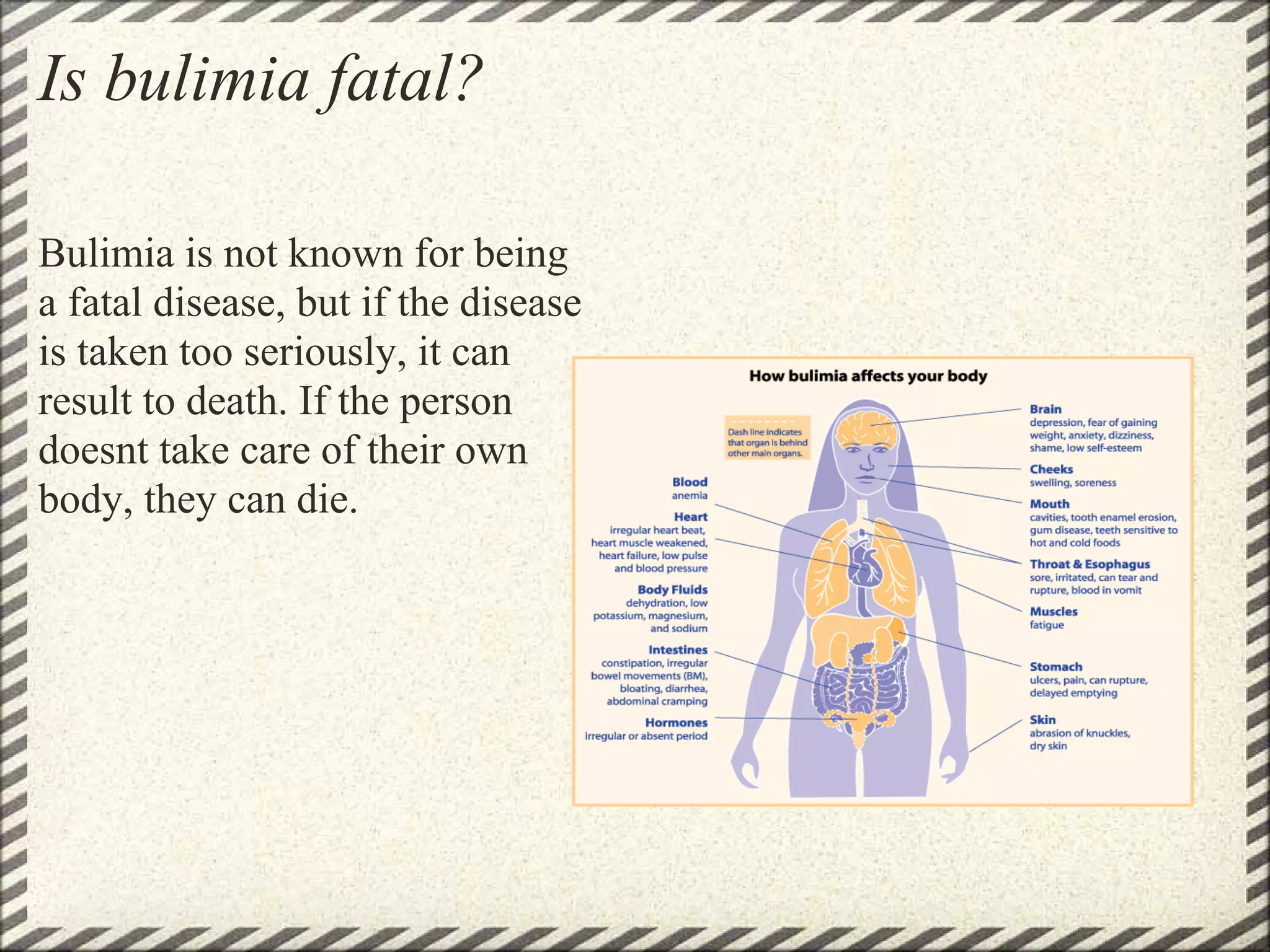 Bulimia | PDF