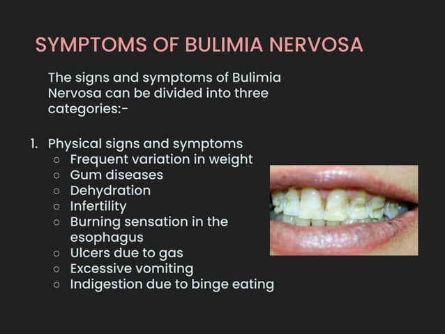 Bulimia | PPT