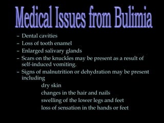 Bulimia nervosa | PPT